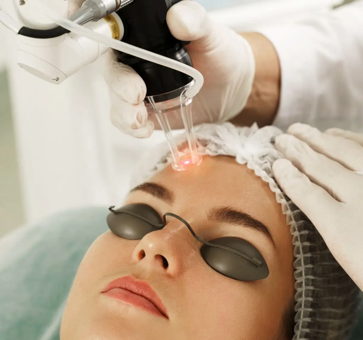Fractional Co2 Laser Treatment Rejuvenation And Radiance